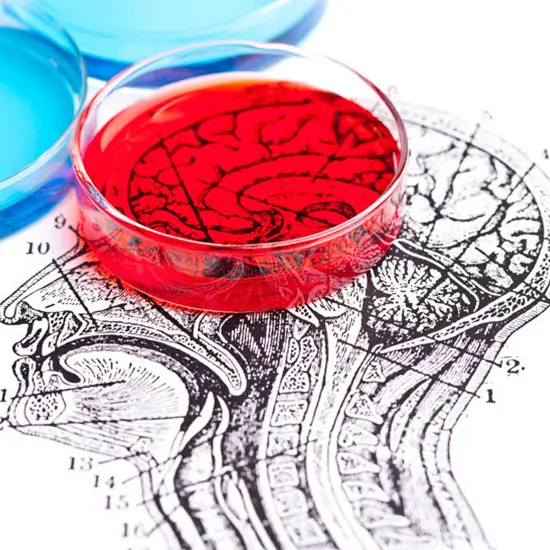 Book Lactate CSF | Test Price In Delhi | Ganesh Diagnostic
