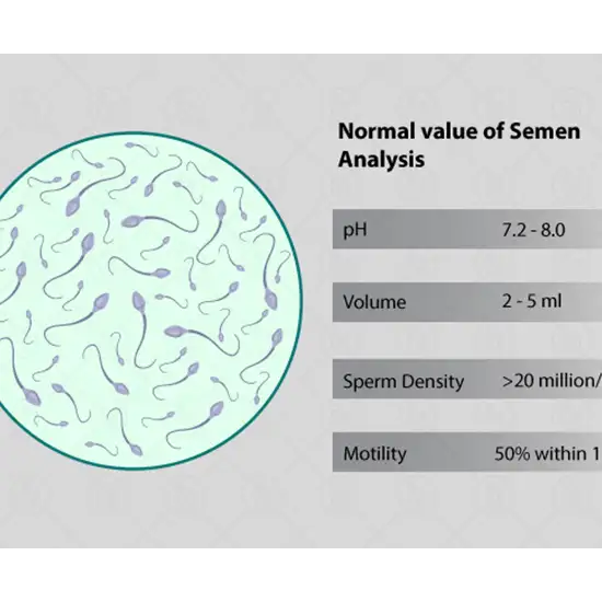 Semen Analysis | Test Price In Delhi | Cost Near Me, India | Ganesh ...