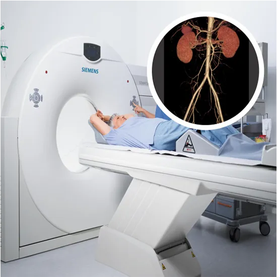 CT Abdomen Angiography Test Price - Lowest Price - Ganesh Diagnostic