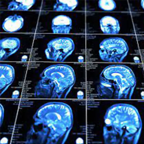 CT Scan Head - Brain Price in Yamuna Vihar - Ganesh Diagnostic