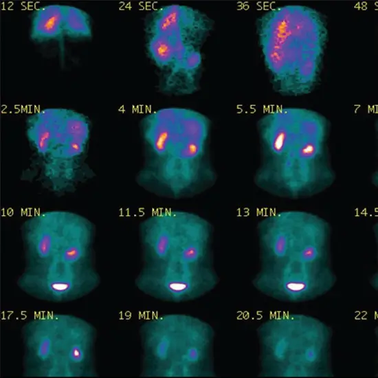 DTPA Scan Procedure in Detail - Ganesh Diagnostic