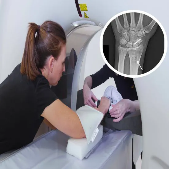 NCCT Wrist Joint Test