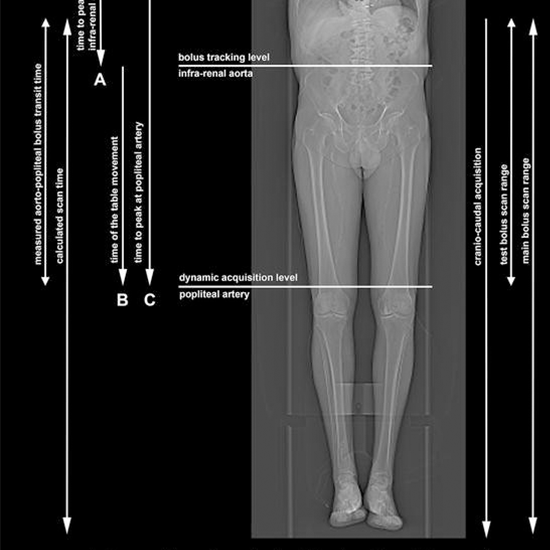 CT Bilateral Thigh and Leg Test Price - Yamuna Vihar Cost - Ganesh ...