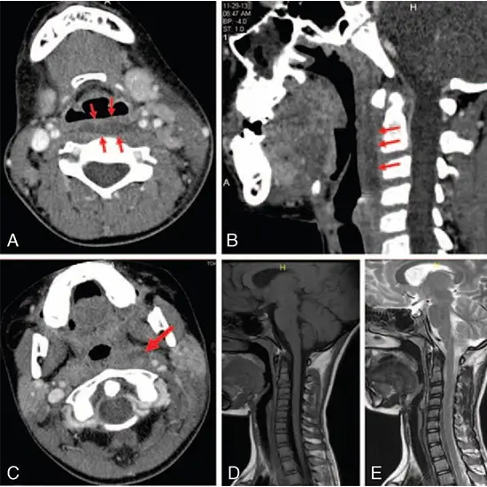 CT Scan Test Flat 50% OFF - CT Scan Centre Near Me in Delhi | Lowest Price