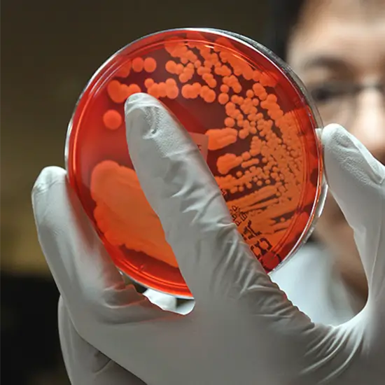 Amino Acids Maple Syrup Urine Disease (MSUD) Panel Plasma Test Cost in ...