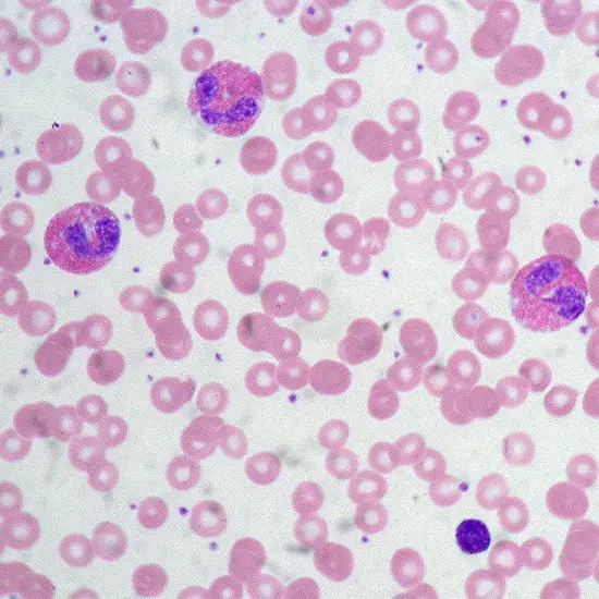 Urine For Eosinophils | Test Price In Delhi | Cost Near Me, India ...