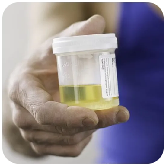 Know Chest X-Ray lateral Decubitus view Procedure - Ganesh Diagnostic