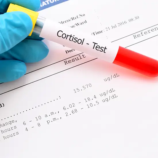 Cortisol Saliva Test Near You in Delhi | Book Test at Low Price