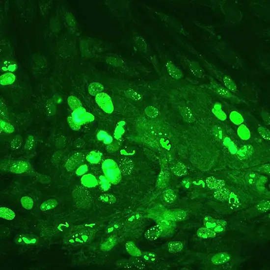 JAK 2 V617F, CALR & MPL Mutation Test Near You in Delhi | Book Test at ...