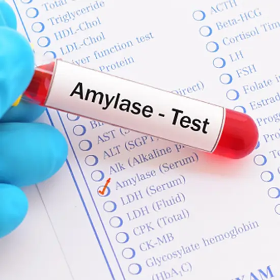 Amylase Fluid Test Near You in Delhi | Book Test at Low Price
