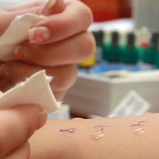 Allergy Screen | Test Price In Delhi | Cost Near Me, India | Ganesh ...