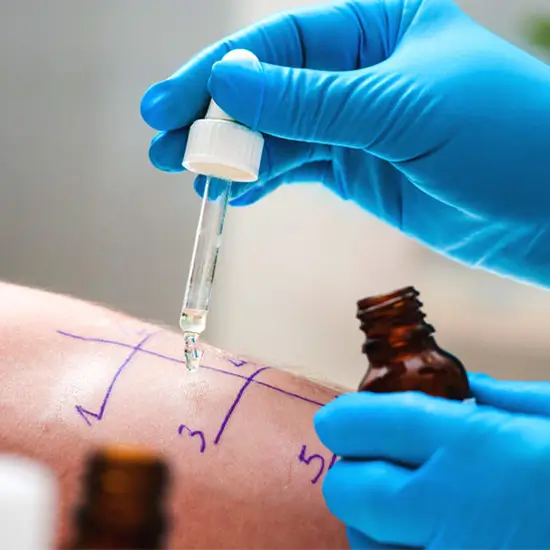 Allergy Comprehensive Profile Test Near You in Delhi | Book Test at Low ...