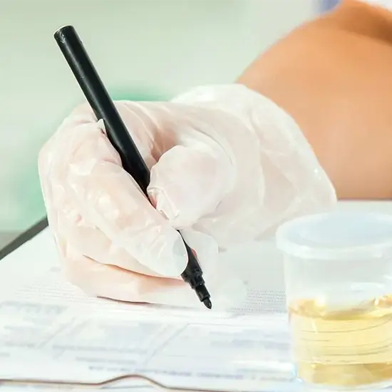 Marijuana Screen Cannabinoids Random Urine Test Near You in Delhi ...