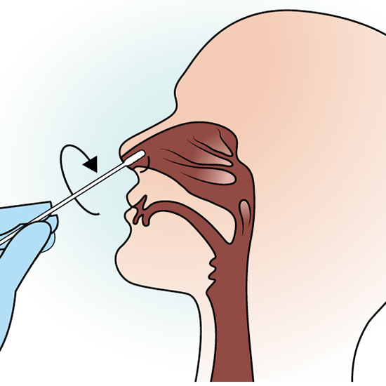 Culture Aerobic Nasal Swab | Test Price In Delhi | Cost Near Me, India ...