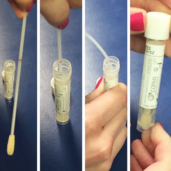 Types Of Ophthalmology Tests | Price List Ophthalmology, Cost In India ...