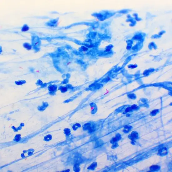 Book Culture AFB (Mycobacterium) Rapid | Test Price In Delhi | Ganesh ...