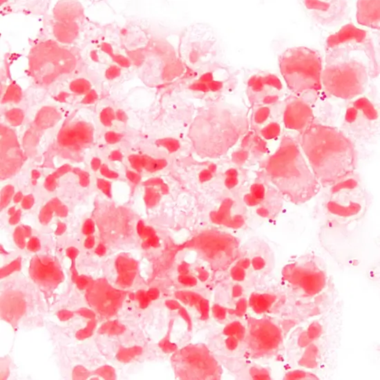 Bacterial Meningitis Confirmatory Panel Test Near You in Delhi | Book ...