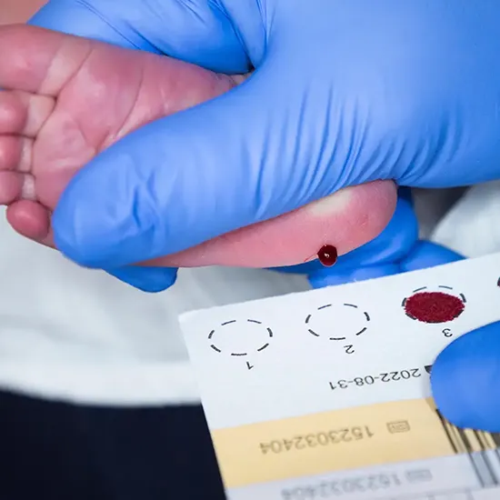 Newborn Screening Test Near You in Delhi | Book Test at Low Price