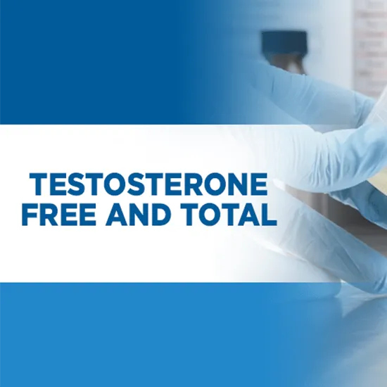 Testosterone Free and Total | Test Price In Delhi, India | Ganesh ...