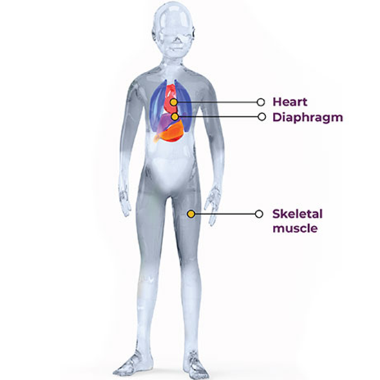 Duchenne/Becker Muscular Dystrophy Gene Mutation | Test at Affordable ...