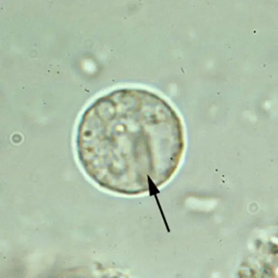 Book Entamoeba Antigen Test, Rapid, Stool | Price Near Me, India ...