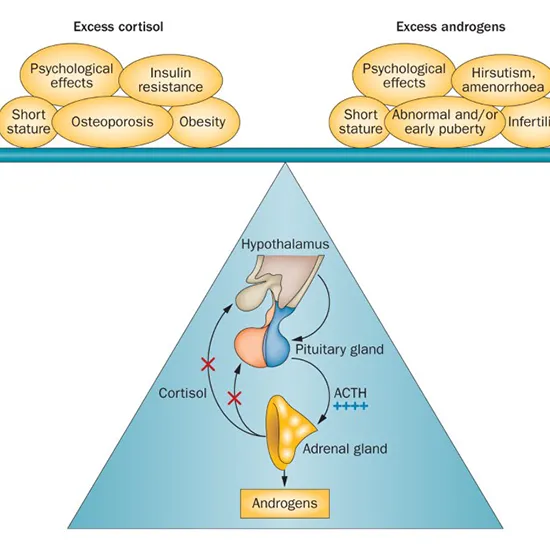 Steroid Panel For Premature Adrenarche | Test Price In Delhi, India ...