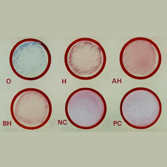 Widal Slide Agglutination | Test Price In Delhi | Cost Near Me, India ...