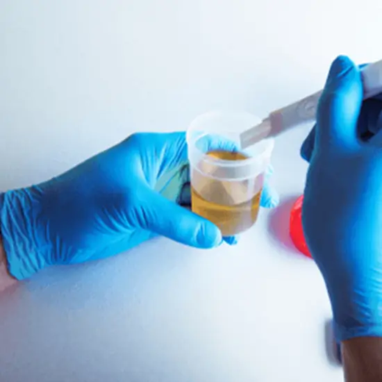 HCG Beta Total Quantitative, Tumor Marker Test Near You in Delhi | Book ...