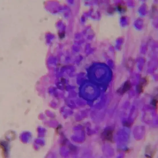 Blastomyces Antibody | Test Price In Delhi | Cost Near Me, India ...