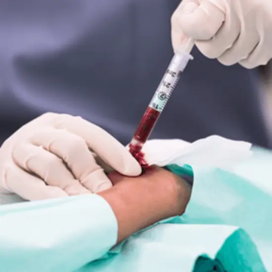 Blood Gas Analysis, Arterial | Test Price In Delhi | Cost Near Me ...