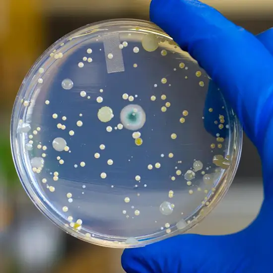 Cultured Aerobic Bacteria Identification | Test Price In Delhi, India ...