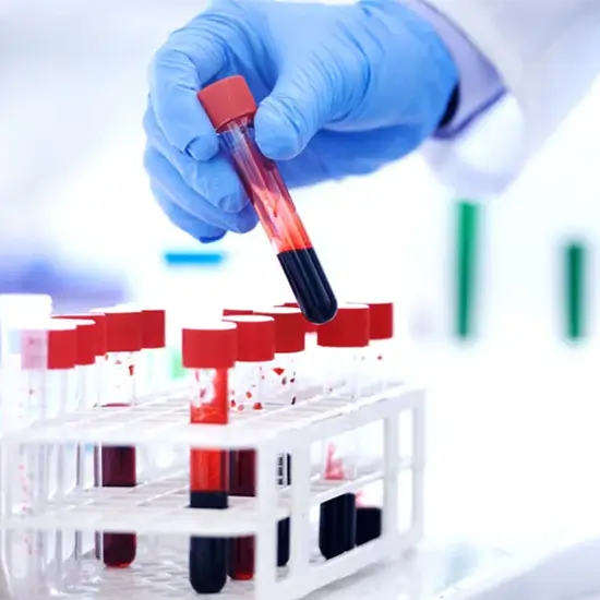 Protein & Immunoglobulin Panel Test Near You in Delhi | Book Test at ...