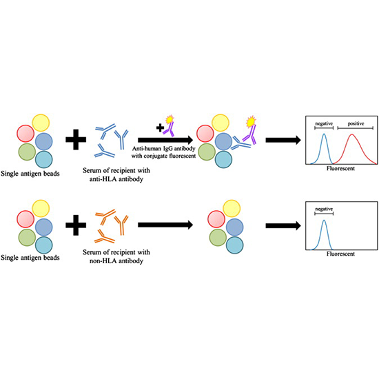 HLA Single Antigen Bead Assay For Class 1 IgG Antibodies; DSA-SAB Class ...