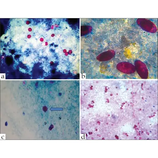 Opportunistic Enteric Parasite Screen, Stool Test Cost in Delhi | GDIC