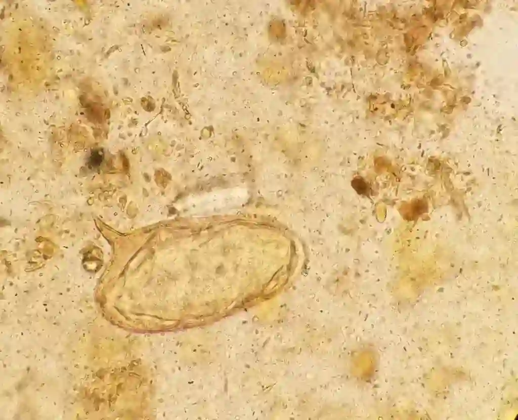 Sputum Examination OVA & Parasites Cost in Delhi Test Price Near Me ...