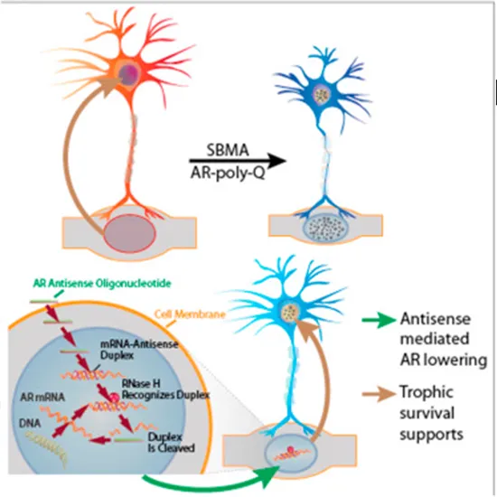 Spinal-Bulbar Muscular Atrophy Cost in Delhi Test Price Near Me, India ...