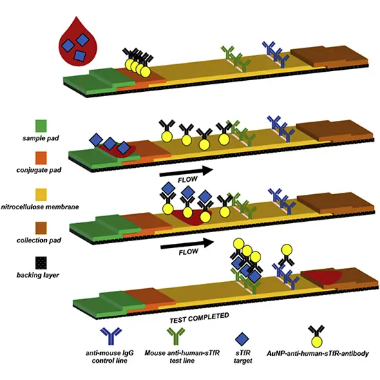 Soluble Transferrin Receptor (sTfR), Serum Cost in Delhi Test Price ...