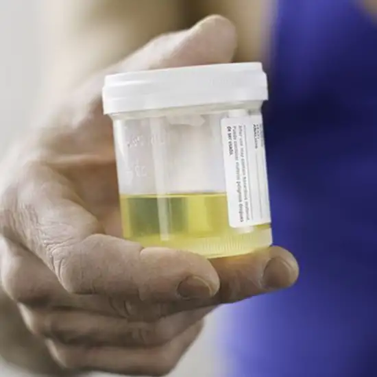 Serotonin Random Urine Cost in Delhi Test Price Near Me, India | GDIC