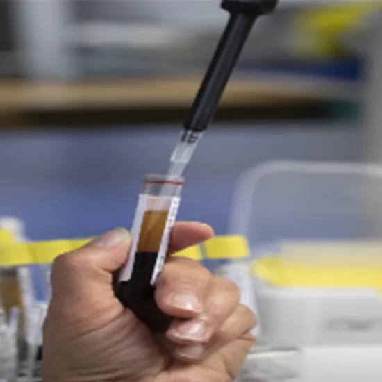 Thrombophilia Comprehensive Profile Test Near You in Delhi | Book Test ...