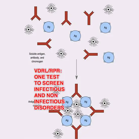 VDRL RPR Serum | Test Price In Delhi | Cost Near Me, India | Ganesh ...