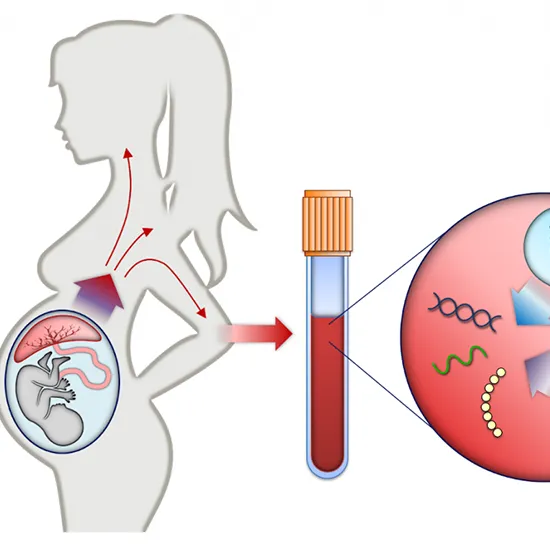 NIPT: Maternal Blood for Fetal DNA (MBFD) Test Cost in Delhi | GDIC