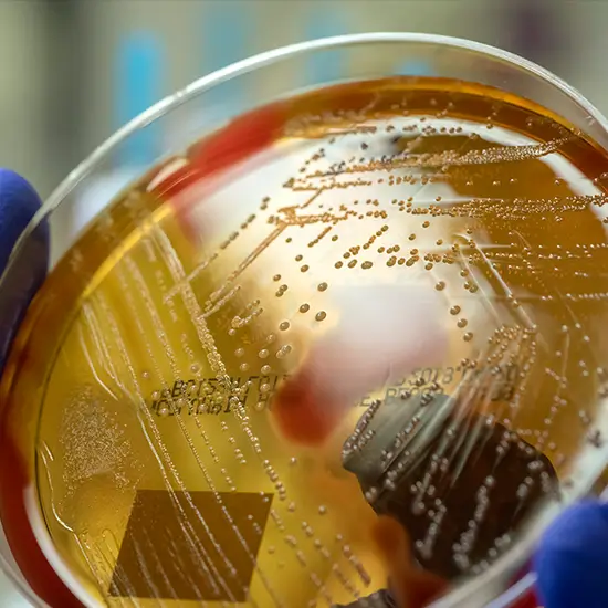 Culture Group B Streptococcus Test Near You in Delhi | Book Test at Low ...