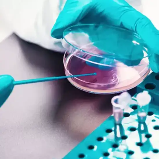 Culture Water Presumptive Coliform Count Test Near me in Delhi | Test ...