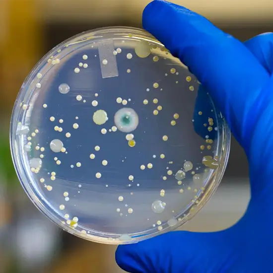 Cultured Anaerobic Bacteria Identification | Test Price In Delhi, India ...