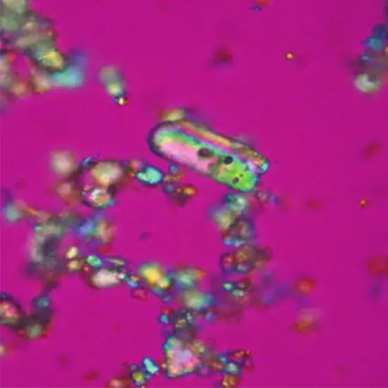 Polarizing Microscopy Body Fluids Test Cost in Delhi | GDIC