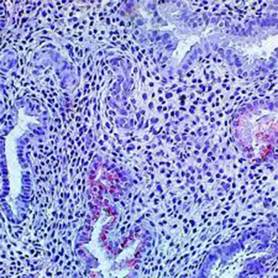 Human Herpesvirus 6 HHV6 Qualitative PCR | Test Price In Delhi, India ...