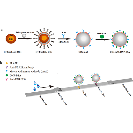 Phospholipase A2 Receptor Antibody (PLA2R) Quantitative Test | GDIC