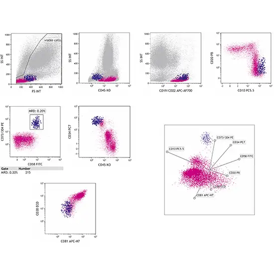 Minimal Residual Disease (MRD) Analysis for B-ALL Test | GDIC