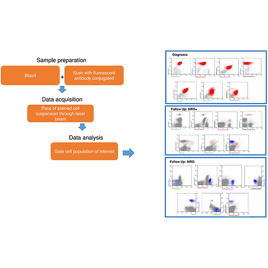 Minimal Residual Disease (MRD) Analysis for T-ALL Test in Delhi | GDIC