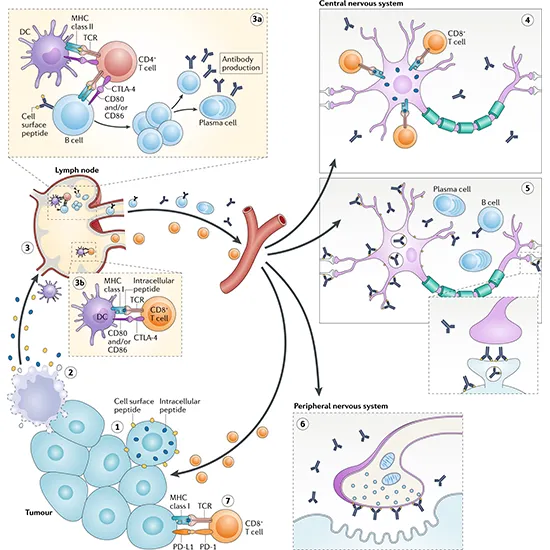 Neuronal (Paraneoplastic) Autoantibodies Profile Advanced Test | GDIC